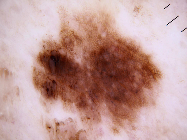 GitHub - OscarC9912/Skin_Cancer_Detect_w_CNN_ViT