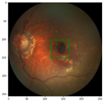 GitHub - HoneyRahmani/SODP: Single Object Detection - Fovea Location Detection - Pytorch