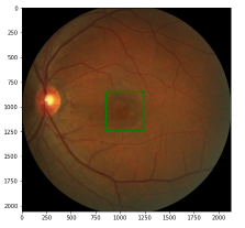 GitHub - HoneyRahmani/SODP: Single Object Detection - Fovea Location Detection - Pytorch