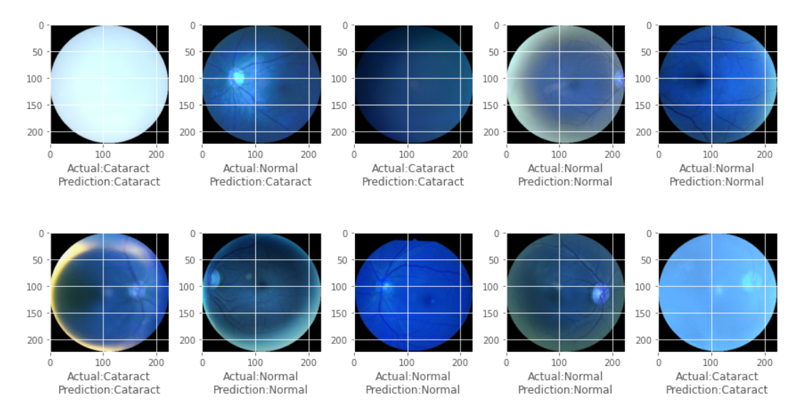 GitHub - SAFZZ/Cataract-Detection
