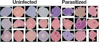 GitHub - Gowri4622/MALARIA-CELL-RECOGNITION