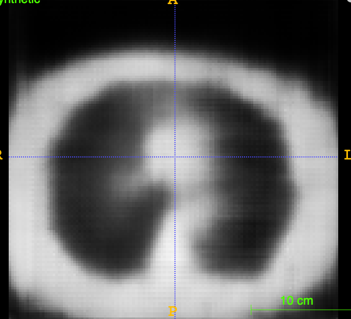 相关课题求助 · Issue #4 · LijunRio/Xrays_CT · GitHub