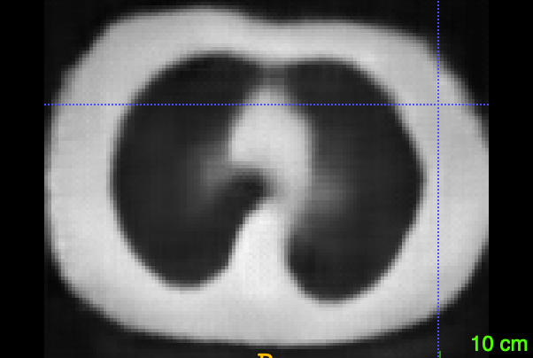 相关课题求助 · Issue #4 · LijunRio/Xrays_CT · GitHub