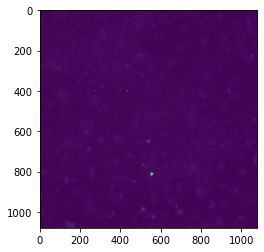 Compression seems to reduce performance · Issue #204 · cytomining/DeepProfiler · GitHub