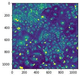 Compression seems to reduce performance · Issue #204 · cytomining/DeepProfiler · GitHub