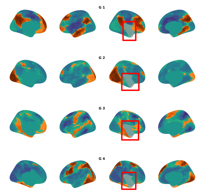 Parcellation Schaefer 1000 - Support request · Issue #102 · MICA-MNI ...