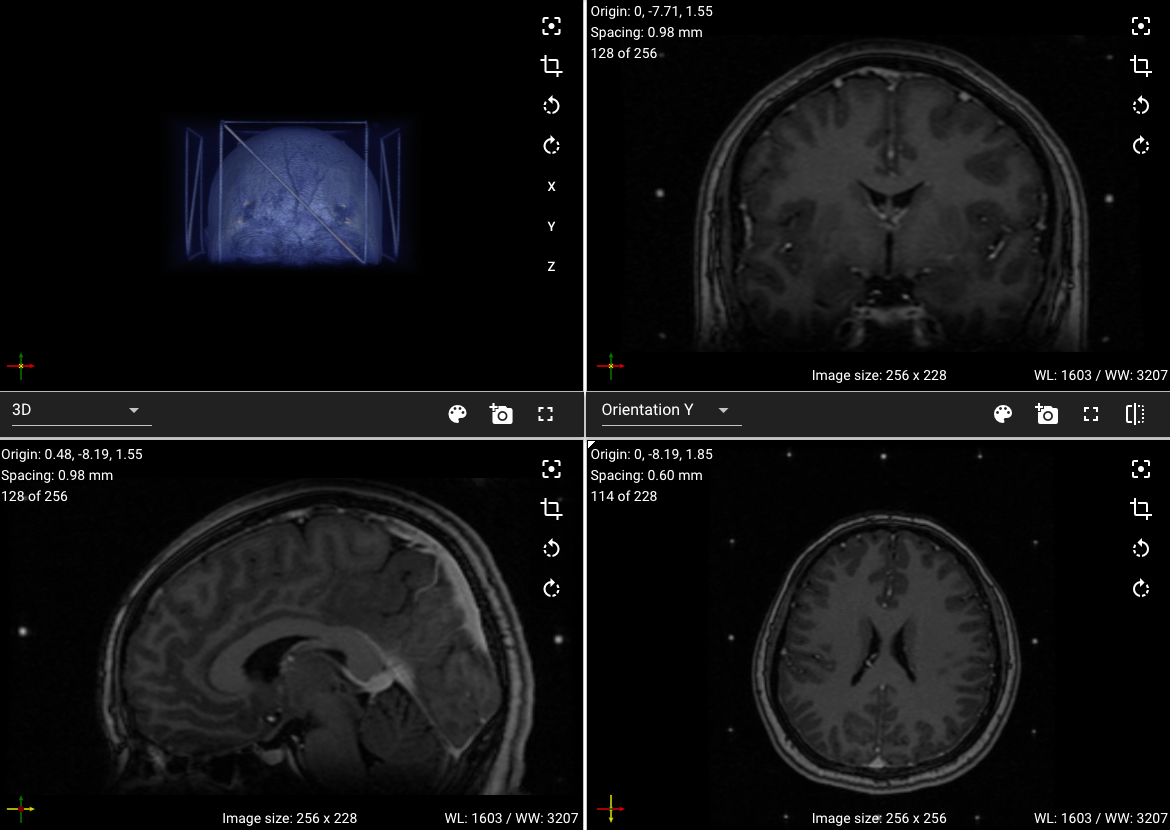 Read Dicom With Jpeg Compress Data · Issue 145 · Insightsoftwareconsortiumitk Wasm · Github