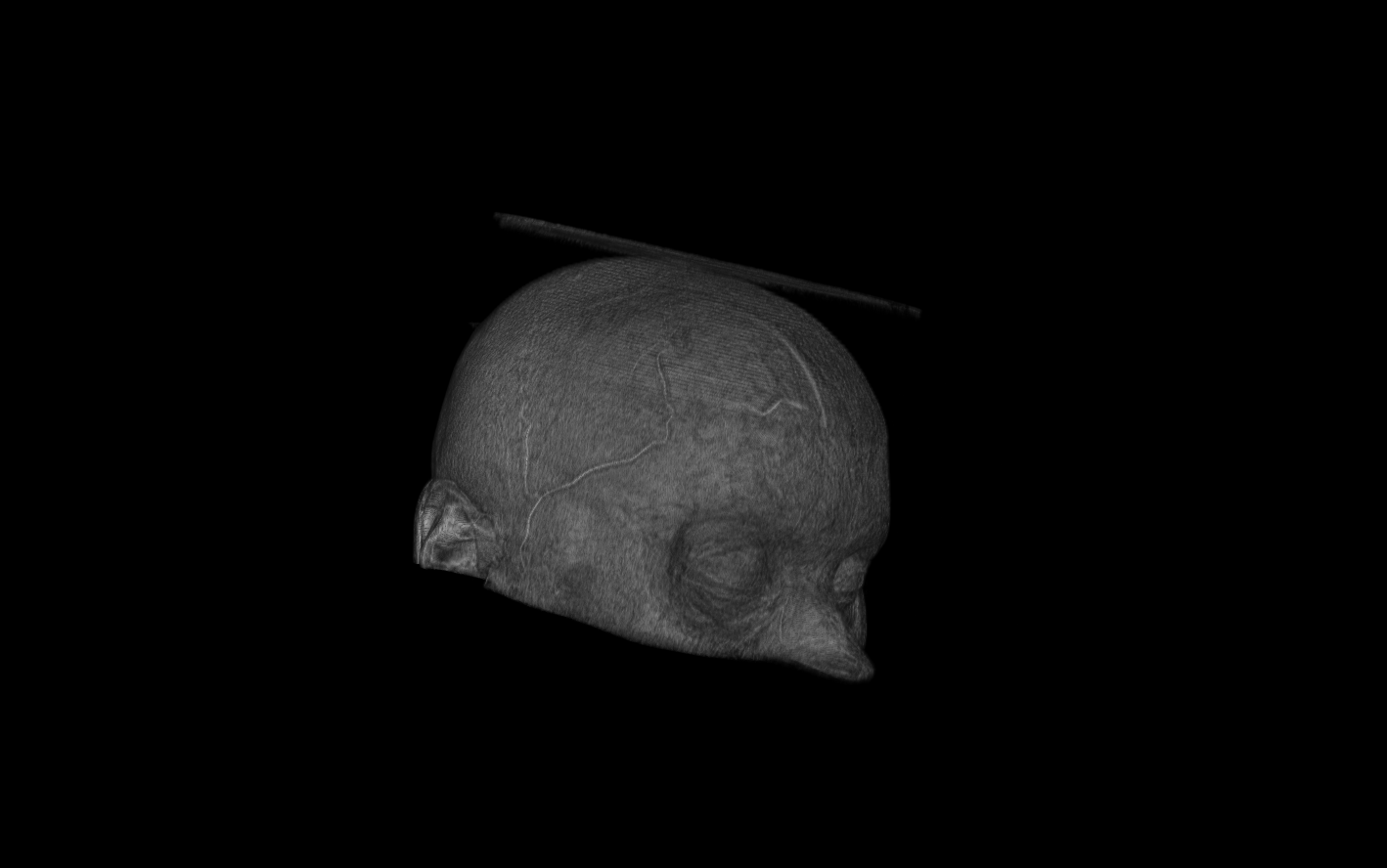 GitHub - DevBroHere/Nifti_Viewer: GUI software for the visualization and basic modification of ...