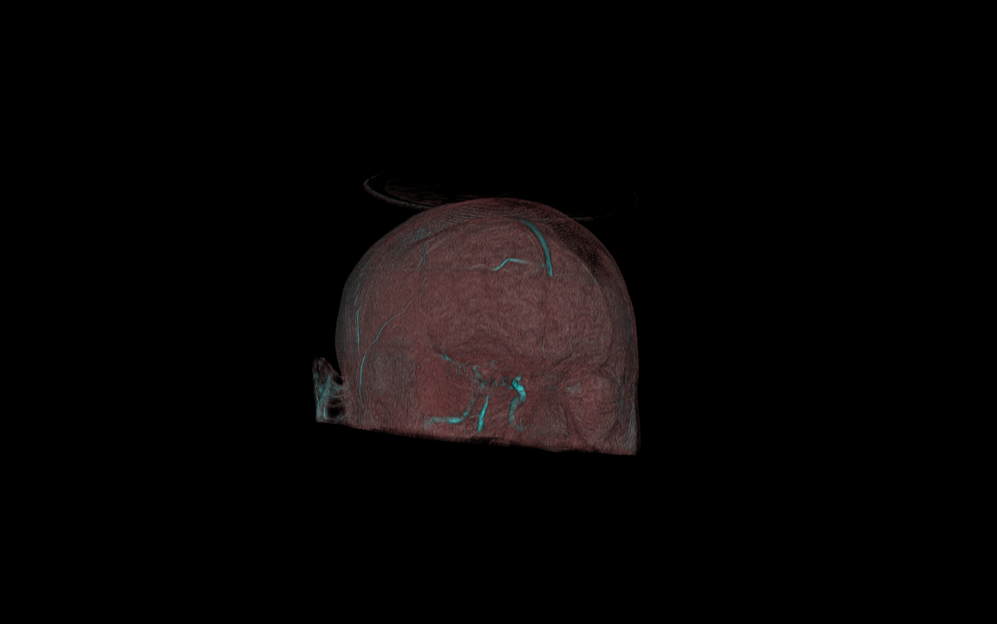 GitHub - DevBroHere/Nifti_Viewer: GUI software for the visualization and basic modification of ...