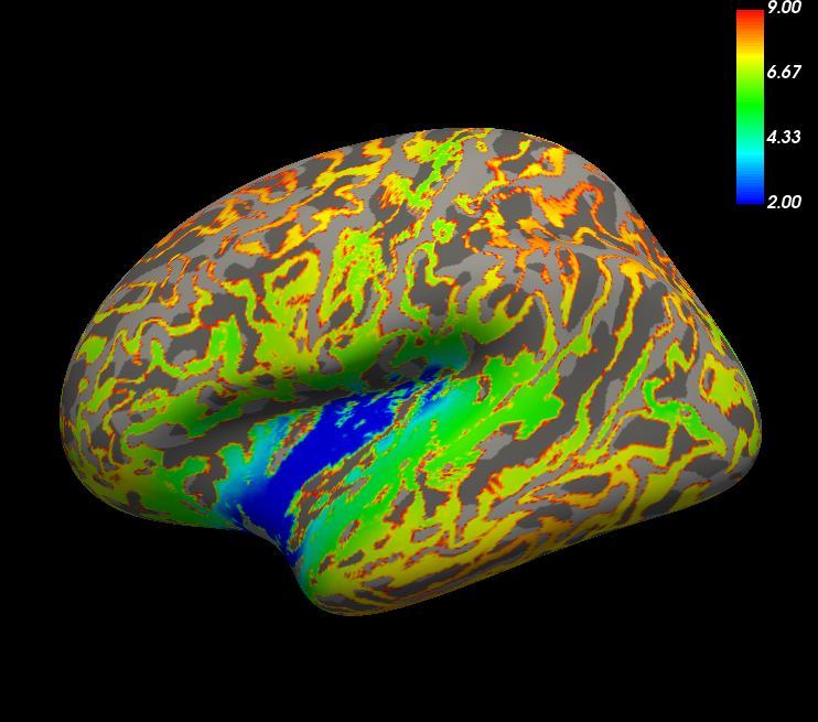 Issues when mapping PET data from MNI152 space to fsaverage · Issue #81 ...