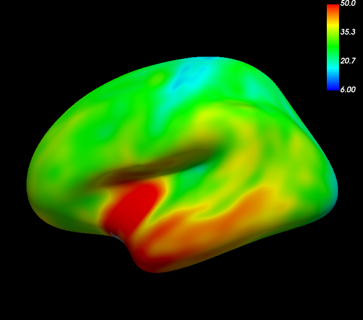 Issues when mapping PET data from MNI152 space to fsaverage · Issue #81 ...