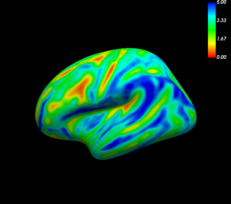 Issues when mapping PET data from MNI152 space to fsaverage · Issue #81 ...