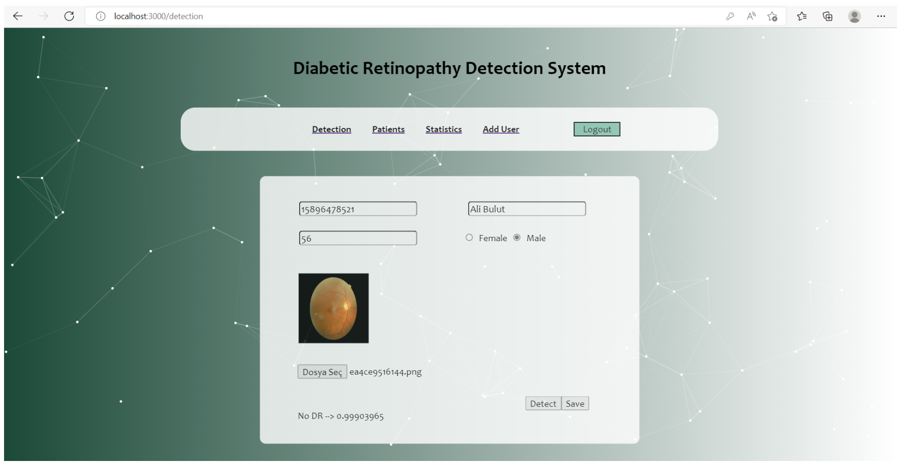 GitHub - hilalakblt/DiabeticRetinopathyDetectionSystem