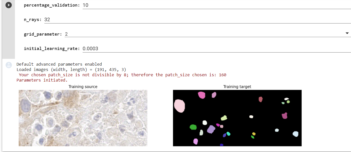 Stardist 2D Notebook error · Issue #63 · HenriquesLab/ZeroCostDL4Mic · GitHub