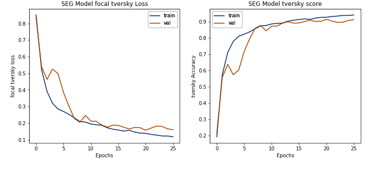 GitHub - Rishika-041/Brain_Mri