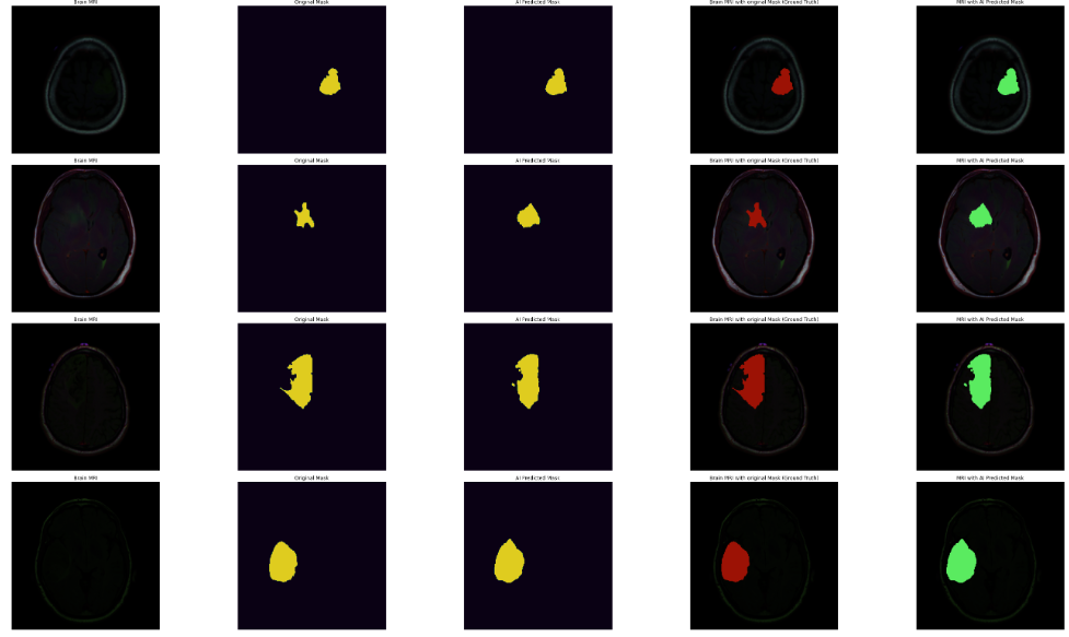 GitHub - Rishika-041/Brain_Mri