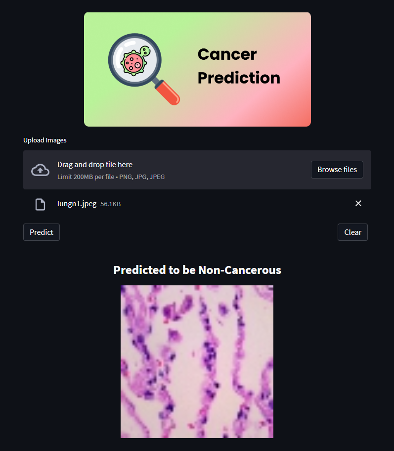 Github Iamsagayaabinesh Cancer Detection Using Convolutional Neural