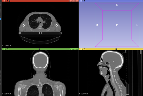 GitHub - harshp77/Tumor-semantic-segmentation: Developing an healthcare ...