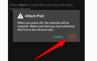 V3B2 : Bug data from different pomps · Issue #815 · nightscout/AndroidAPS · GitHub