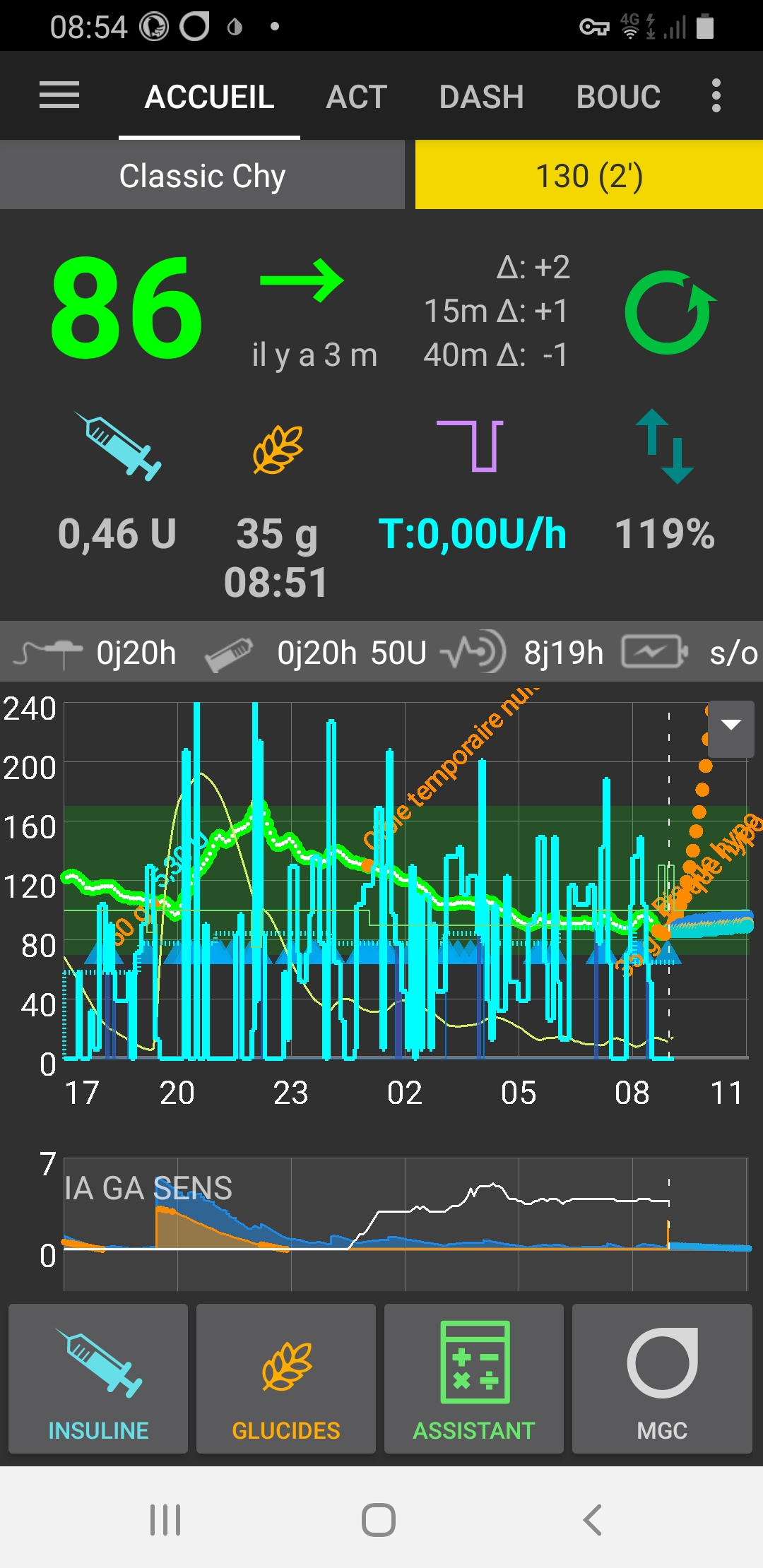 Dev 20/ Crazy calculation "loop" on main UI with strange graphics ...