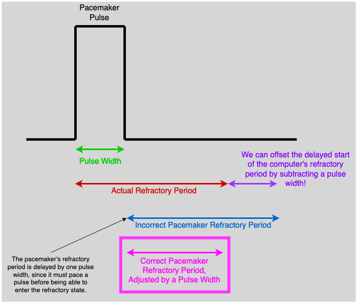 GitHub - alusch7/Pacemaker29: A functional electronic pacemaker and pacemaker GUI made with ...