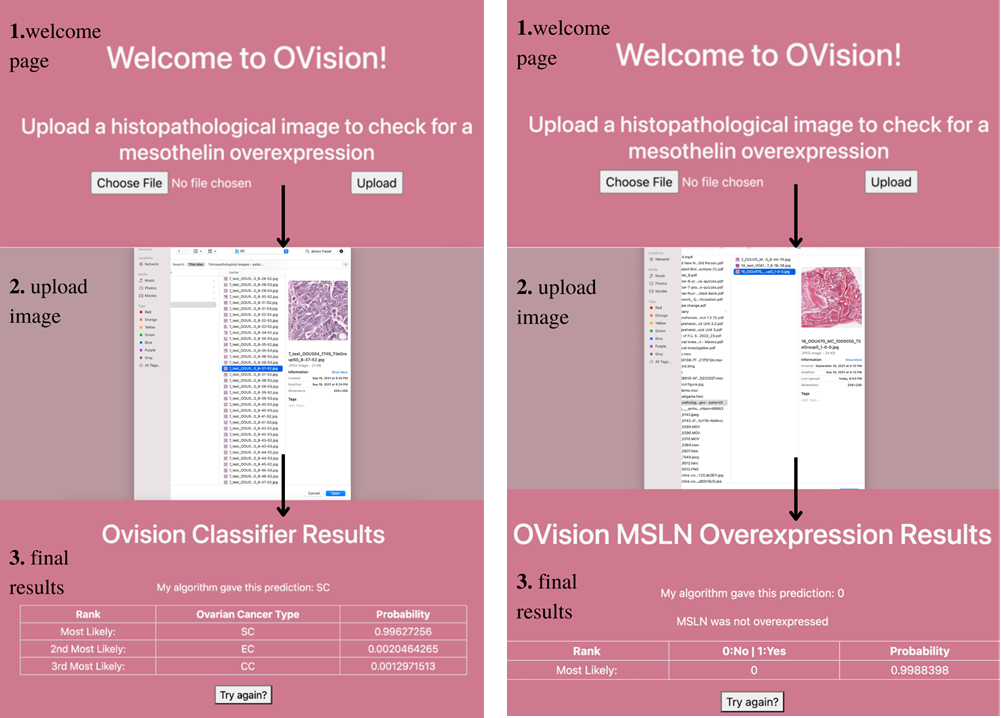 GitHub - samairamehta/OVision: OVision: Automatic Assessment of Ovarian Cancer Features ...