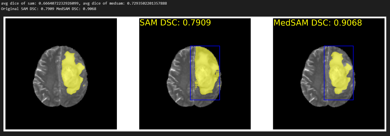 GitHub - uriel0co/mri_deep_project: This is a repository for our final ...