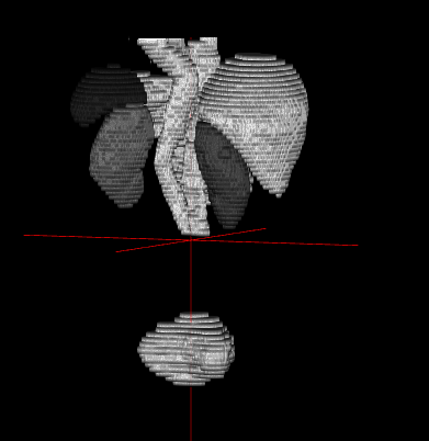 area and angle measurement · Issue #595 · niivue/niivue · GitHub
