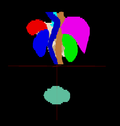 loadDrawingFromUrl vs loadVolumes · Issue #616 · niivue/niivue · GitHub