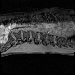 GitHub - chenjiefighting/CT-Image-Spine-Distortion-Area-Detection ...