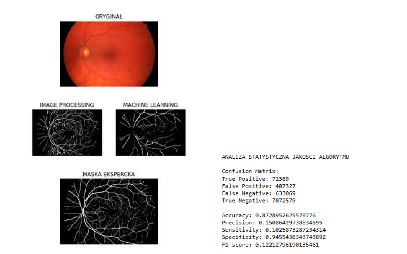GitHub - macluczak/Recognition-of-blood-vessels: Detection of blood ...