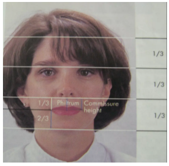 GitHub - yousrajnahi/Facial-symmetry-estimation: This project detect ...