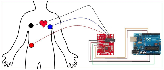 Pontos de Monitoramento Cardíaco: · Issue #1 · Ivo-Brites/arduino_ecg ...