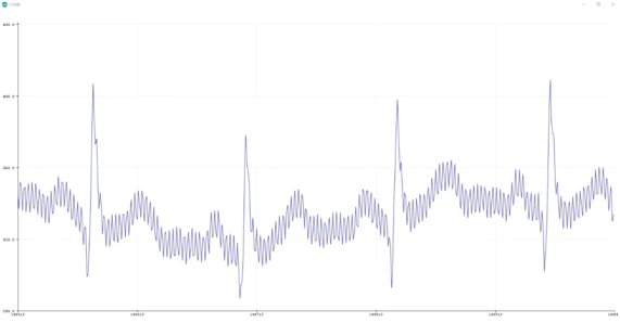 GitHub - Ivo-Brites/arduino_ecg_ad8232