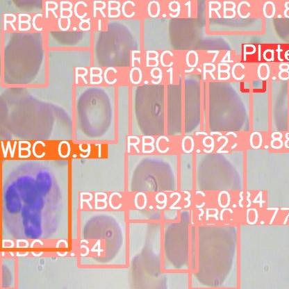 GitHub - ThanhV99/object_detection_bccd_Yolov5_Colab