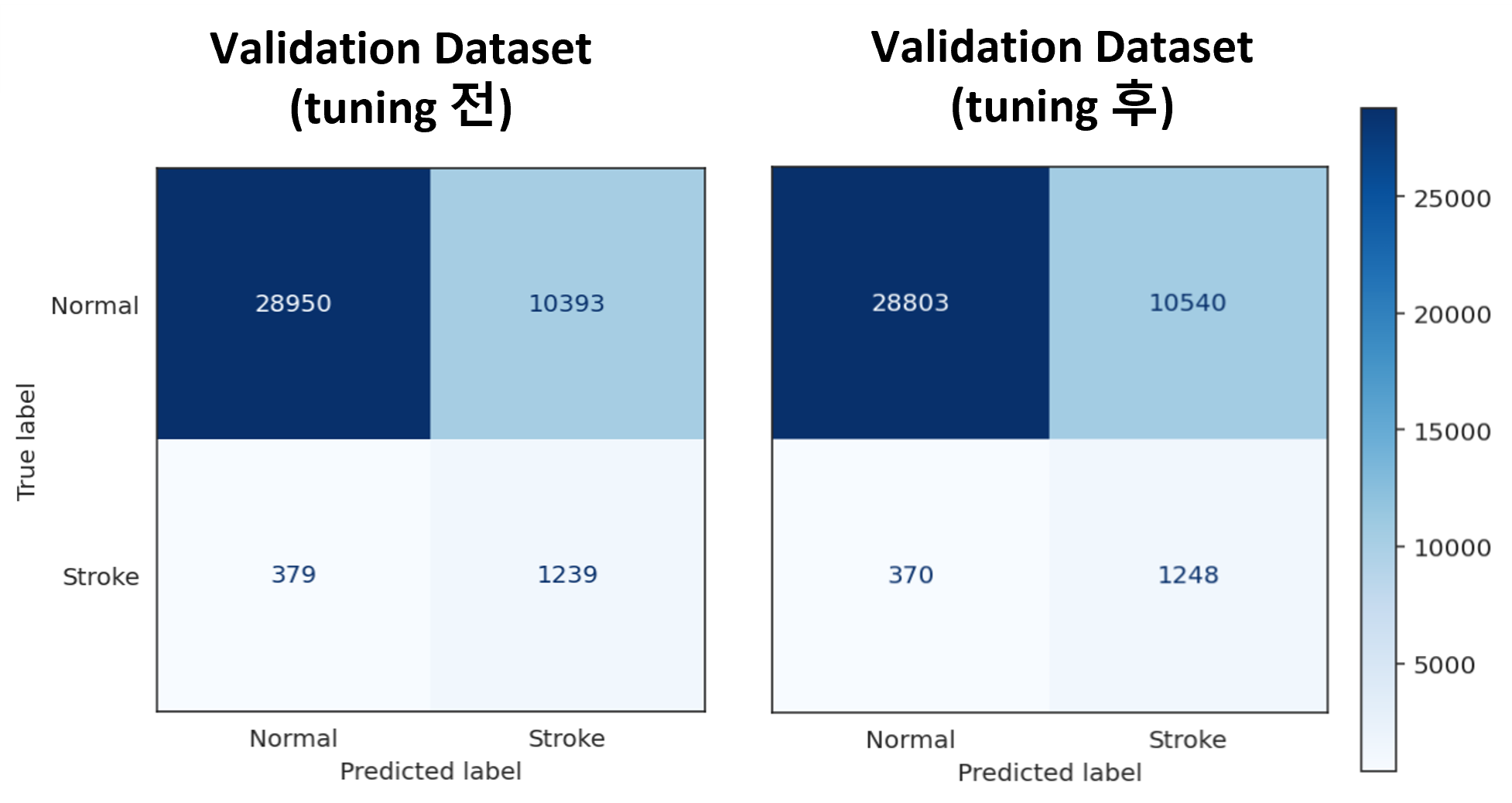 GitHub - jmj072/ML-Prediction-Stroke: 전화 설문조사 데이터셋을 이용한 뇌졸중 발병 예측 모델 생성