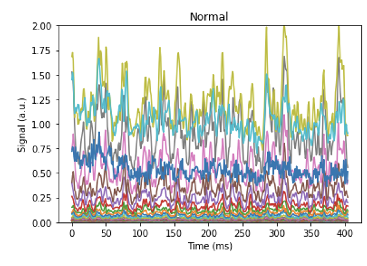GitHub - PriyamvadaKumar/Heart-Beat-Anomaly-Detection-: Anomaly detection in heart beat data