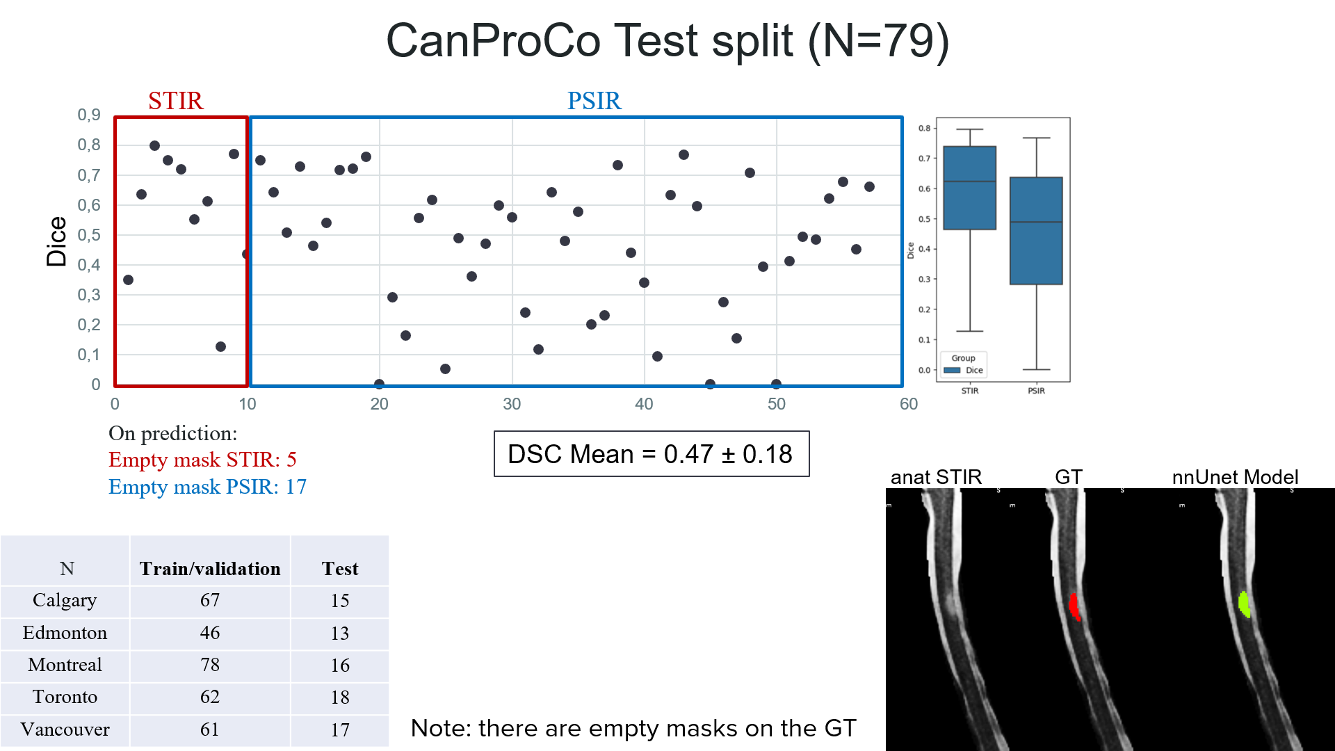 GitHub - brainhack-school2023/laines_project: Repository of Nilser LAINES for this Brainhack ...