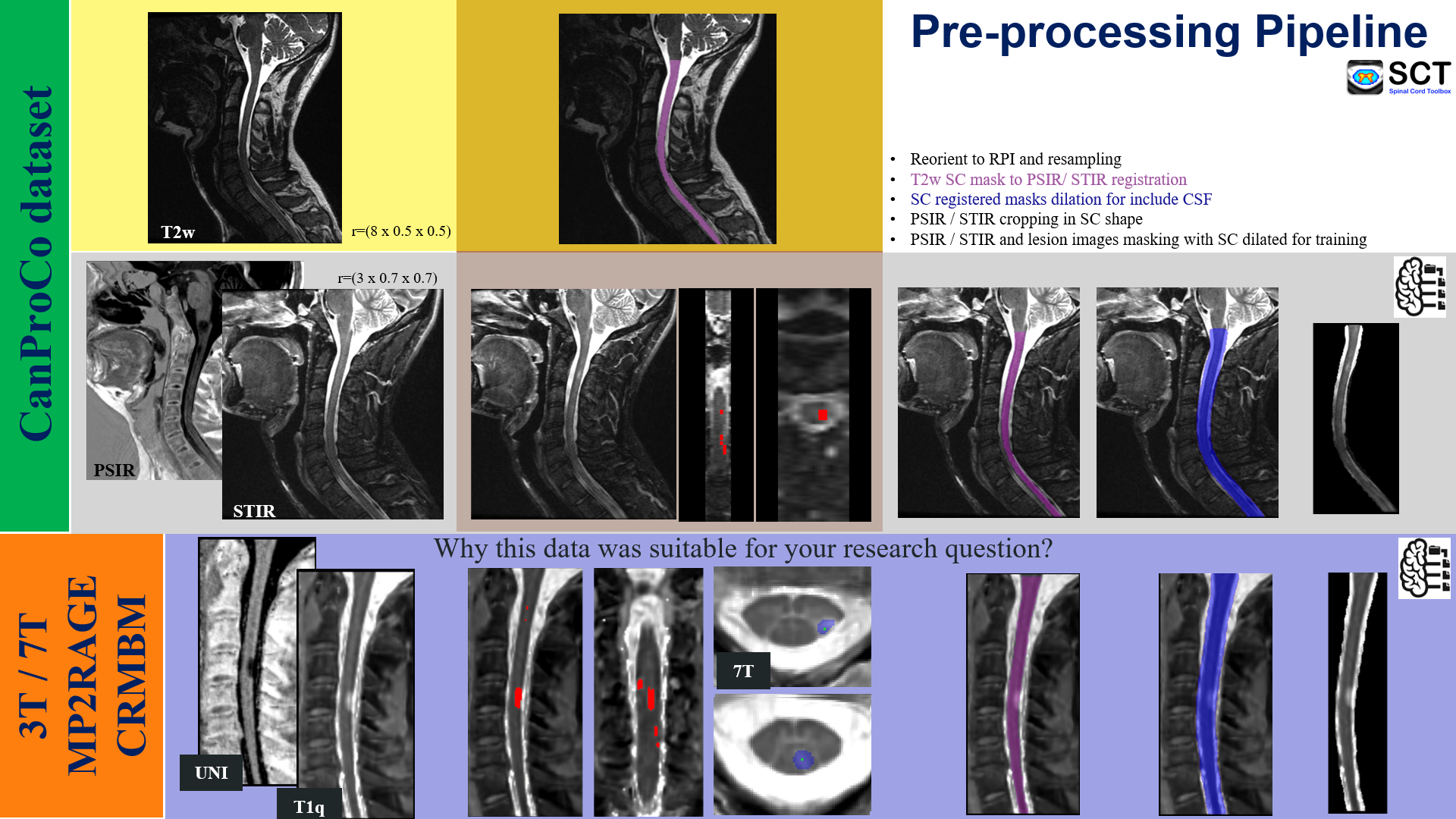 GitHub - brainhack-school2023/laines_project: Repository of Nilser LAINES for this Brainhack ...