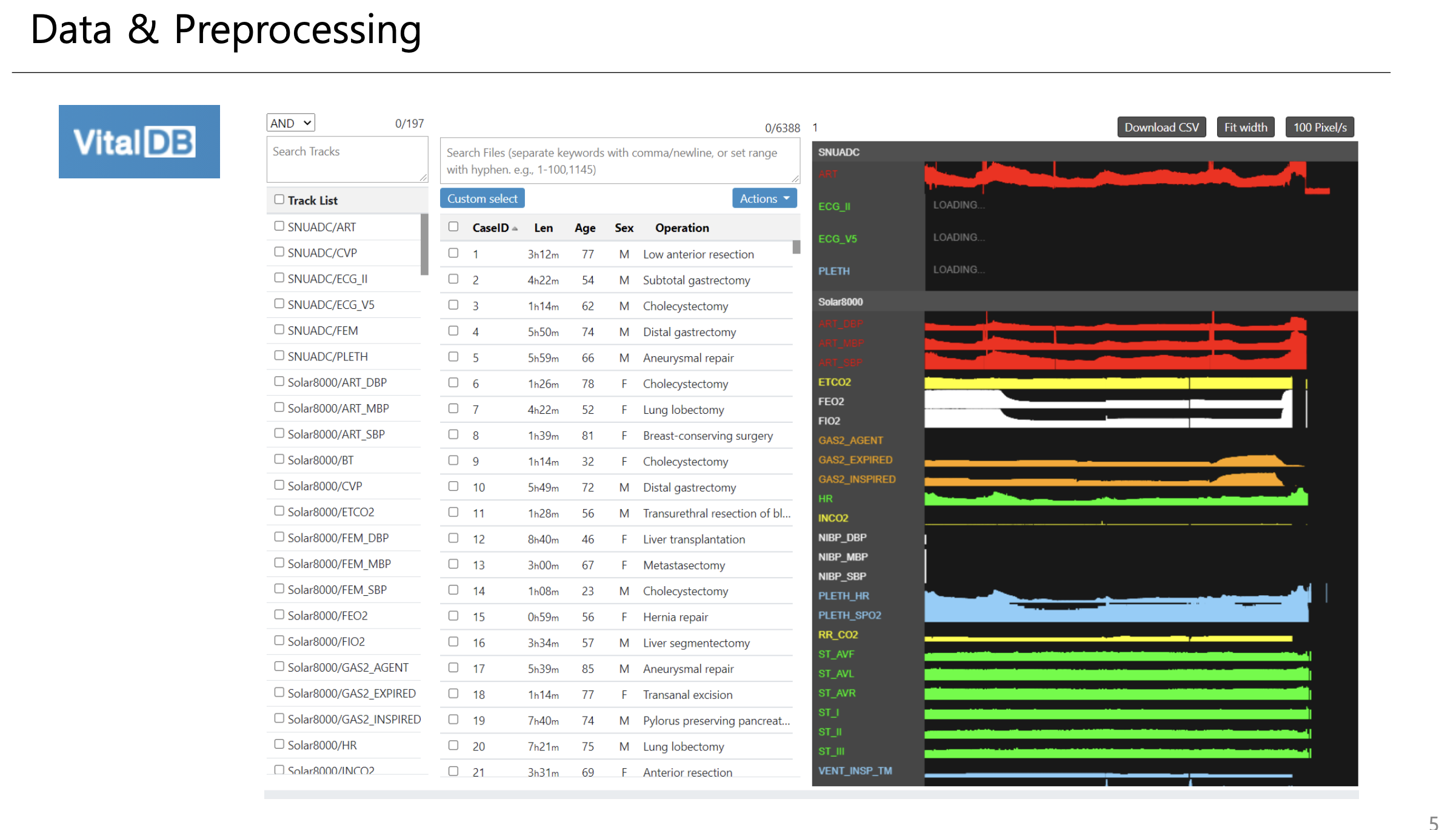 GitHub - ryuzho/ViT_hypotension_prediction: Vision Transformer for the prediction of ...