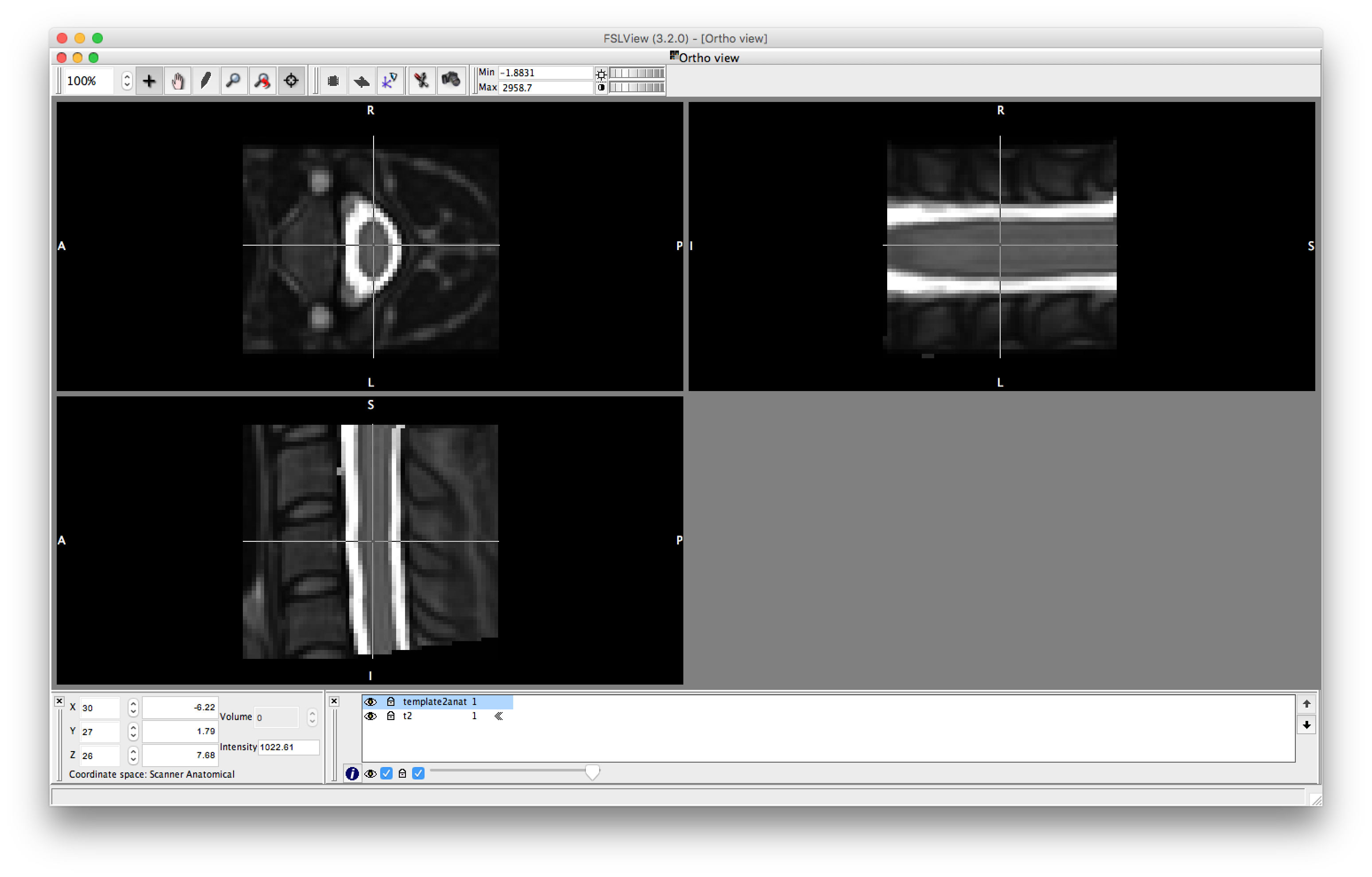 Improvements in straightening and registration to the template by benjamindeleener · Pull ...