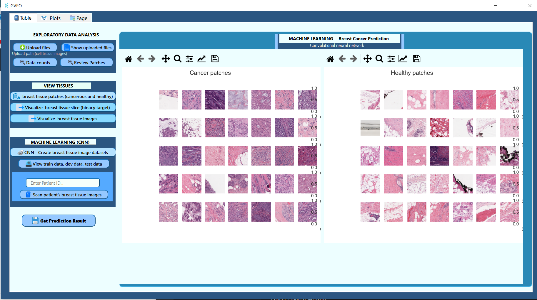 Github Annieatneu Machine Learning Gui Based For Breast Cancer Detection