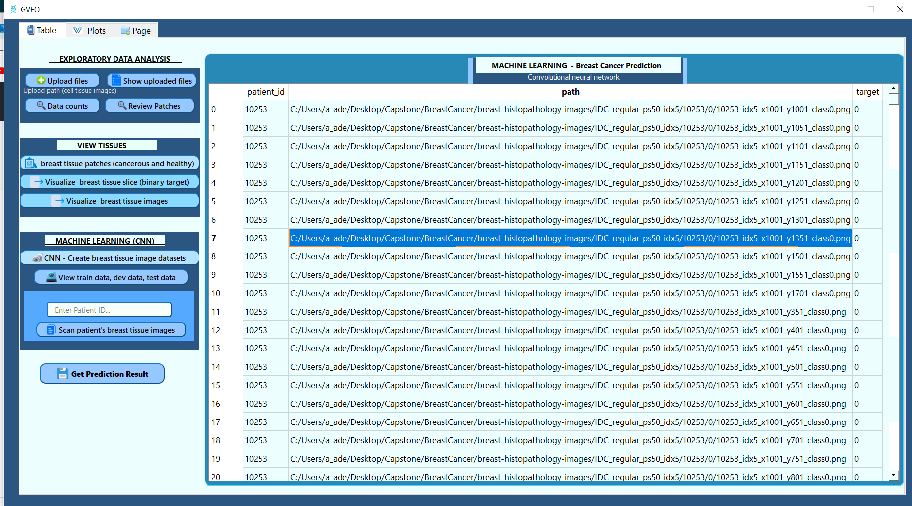 Github Annieatneu Machine Learning Gui Based For Breast Cancer Detection