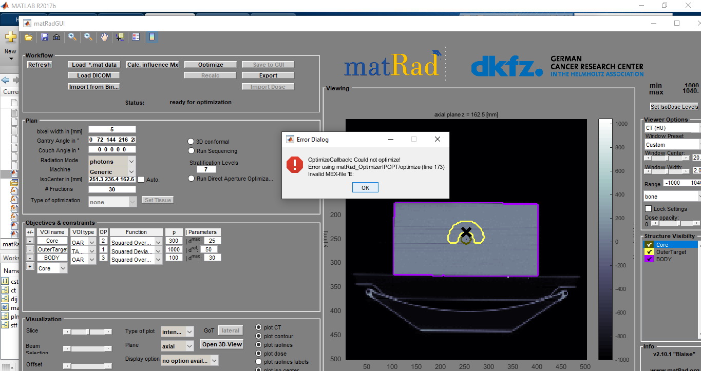 matRad_OptimizerIPOPT error for matlab 2017b · Issue #481 · e0404/matRad · GitHub