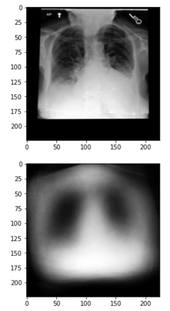GitHub - Sam-Oliveira/chestx-rays