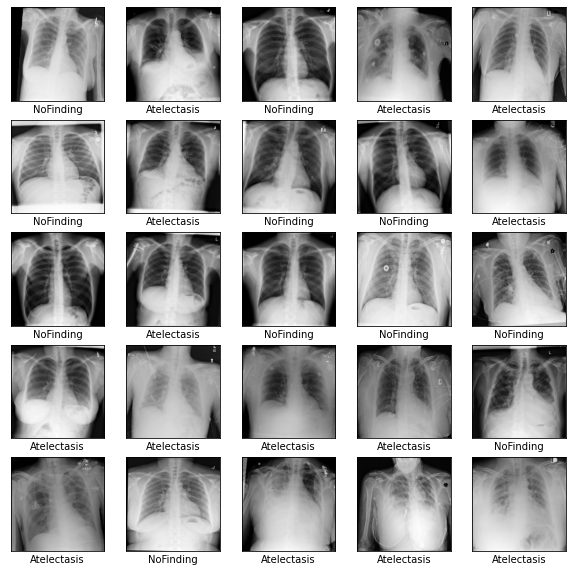 GitHub - Vurimindi2021/X-Ray-Image-Classifier: Developing a model to detect pneumonia & other ...