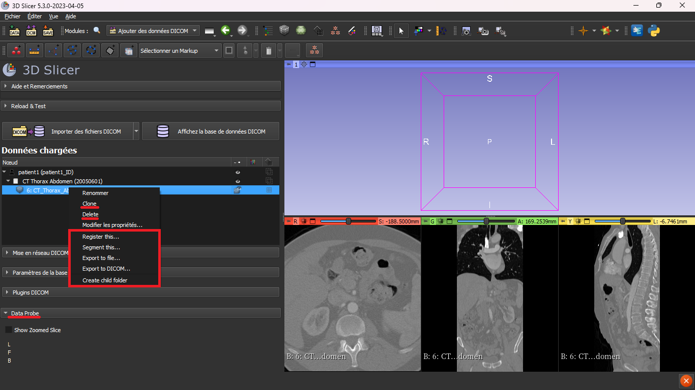 DICOM module is not yet fully translated into French Slicer version 5.3.0 2023-04-05 · Issue #23 ...