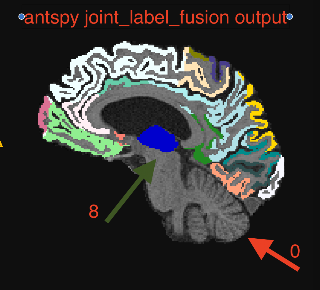 Issue with antspy jointlabelfusion · Issue #251 · ANTsX/ANTsPy · GitHub