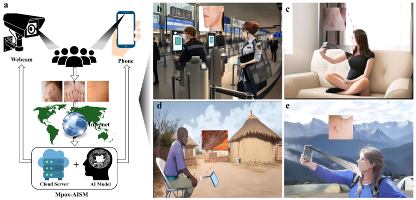 GitHub - zhenzhang-li/Mpox-AISM: Mpox-AISM: AI-Mediated Super Monitoring for Forestalling ...