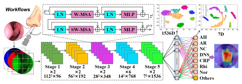 GitHub - zhenzhang-li/Nose-AI-system